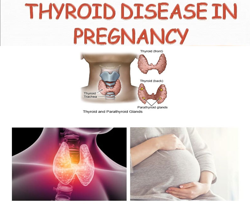 Thyroid problems in pregnancy Stay aware for safe motherhood